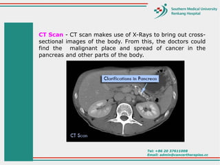 Diagnosis of Pancreatic Cancer | PPT
