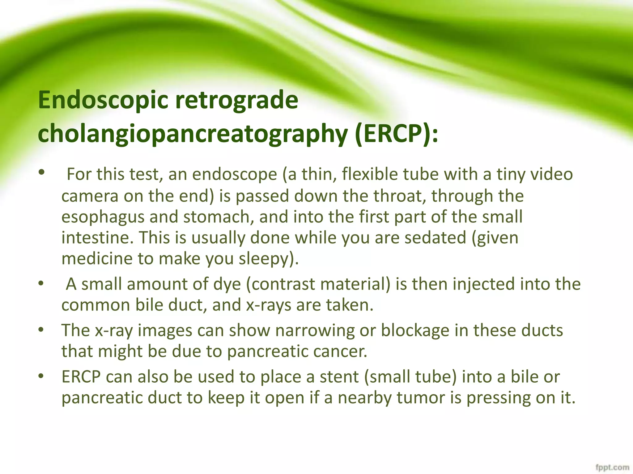 Pancreatic cancer | PPTX
