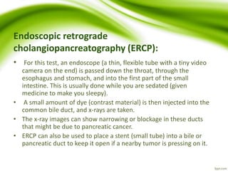 Pancreatic cancer | PPTX