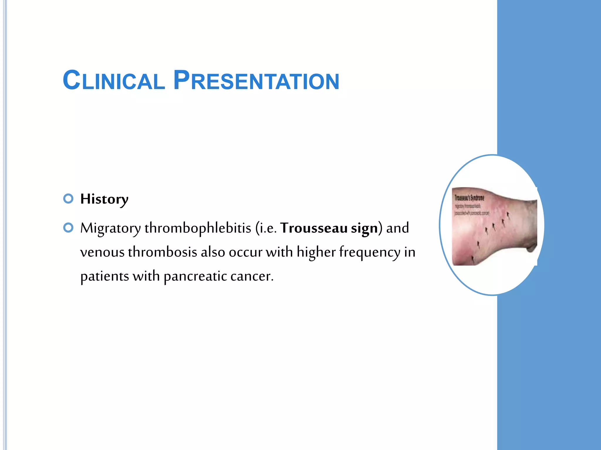 Pancreatic cancer | PPT