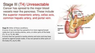 Pancreatic cancer | PPTX