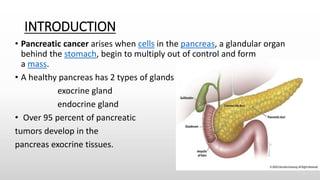 Pancreatic cancer | PPTX