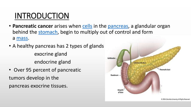 Pancreatic cancer | PPTX