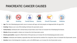 Pancreatic Cancer : Symptoms, Cause, and Treatments Options | PPT