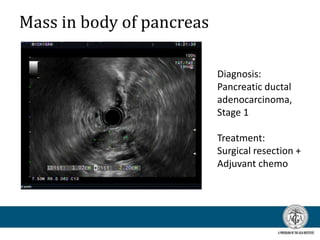 Pancreatic_Cancer_-_Rhim.power point presentation | PPT