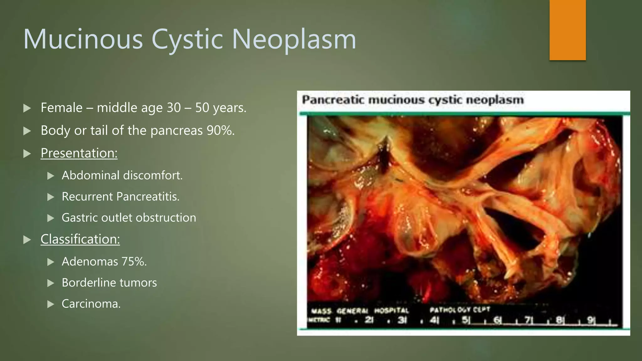 Pancreatic cystic neoplasm: Definition, Classification, Diagnosis and ...