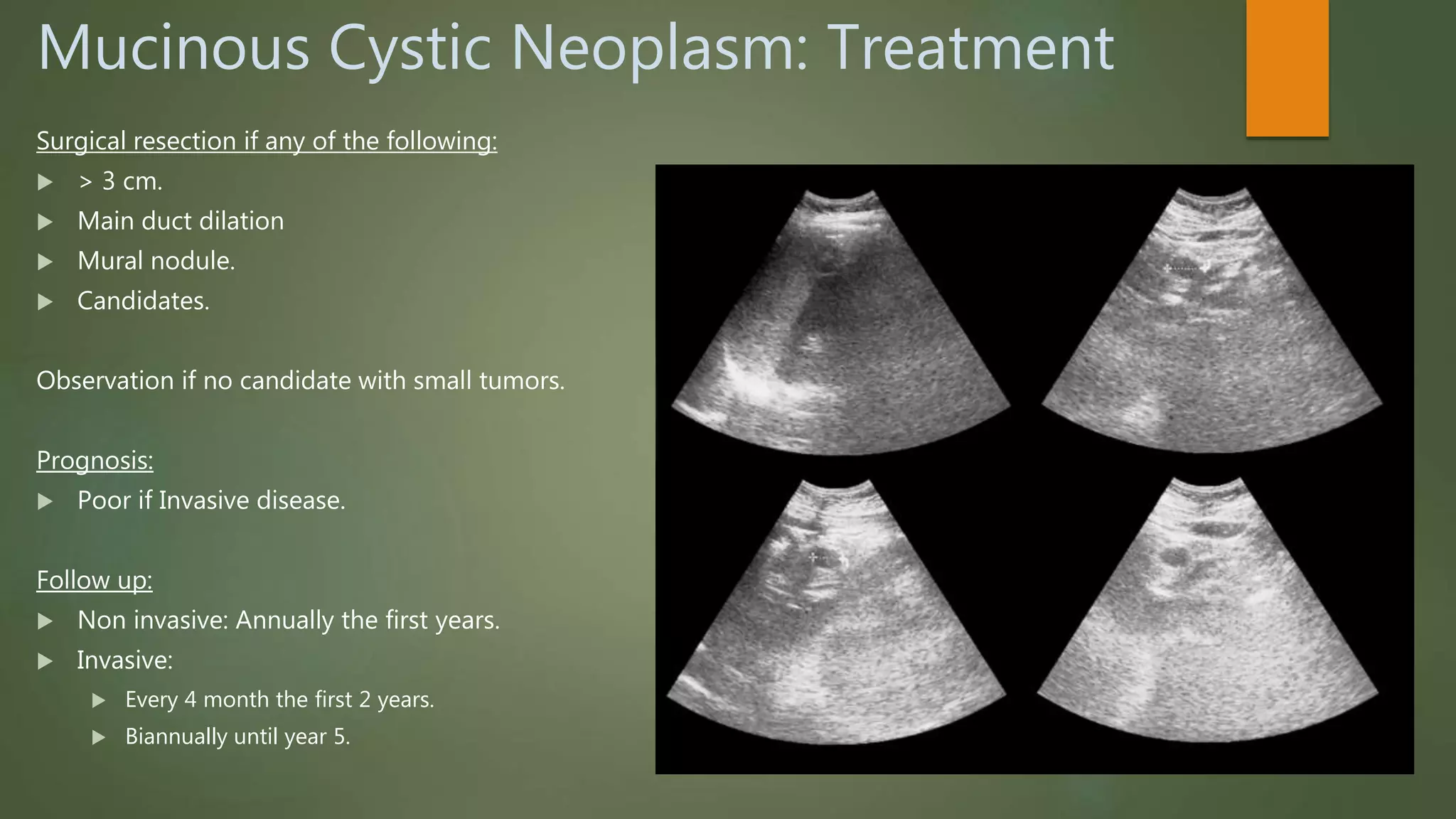 Pancreatic cystic neoplasm: Definition, Classification, Diagnosis and ...