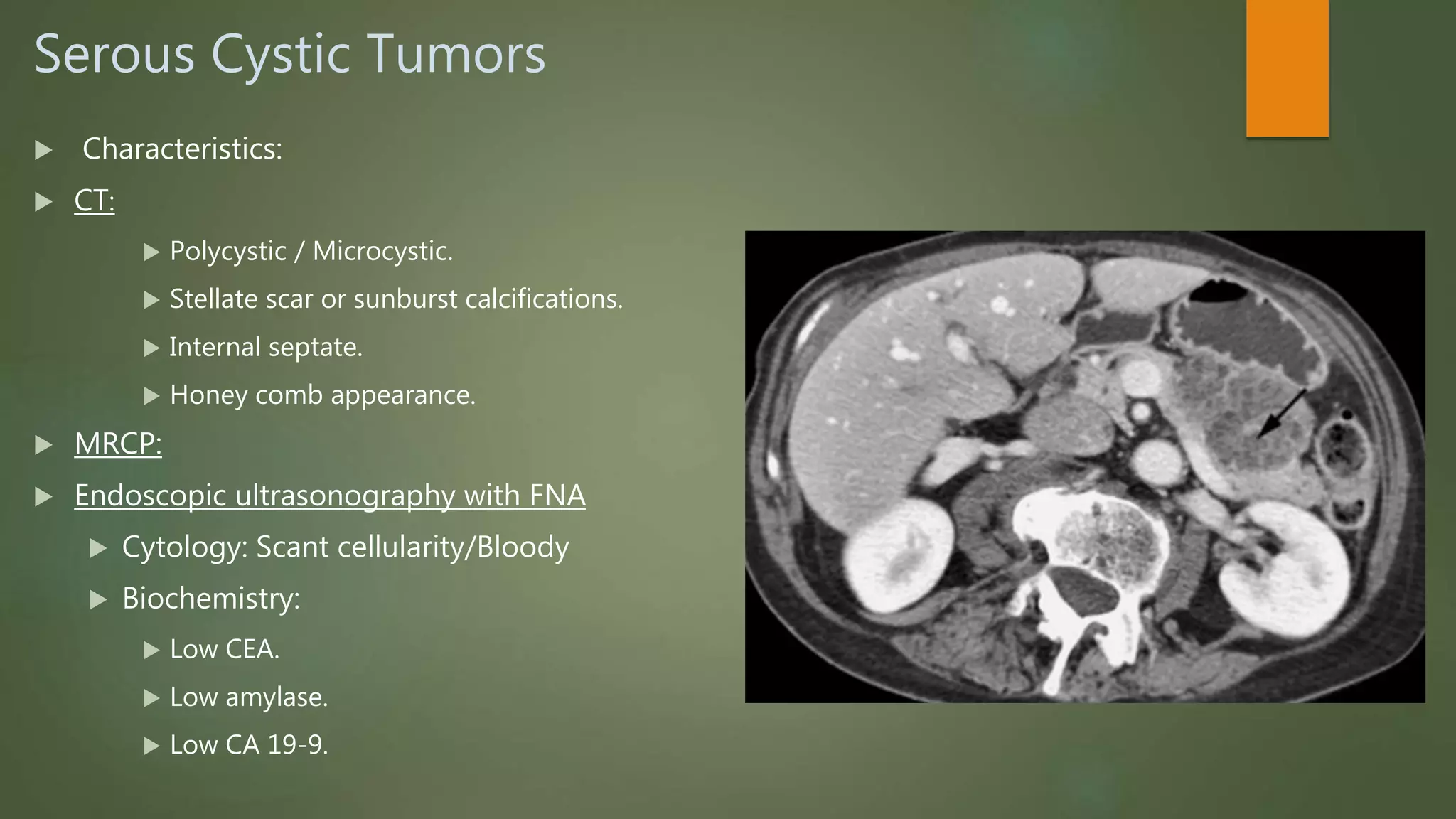 Pancreatic cystic neoplasm: Definition, Classification, Diagnosis and ...