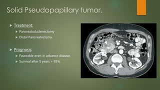 Pancreatic cystic neoplasm: Definition, Classification, Diagnosis and ...