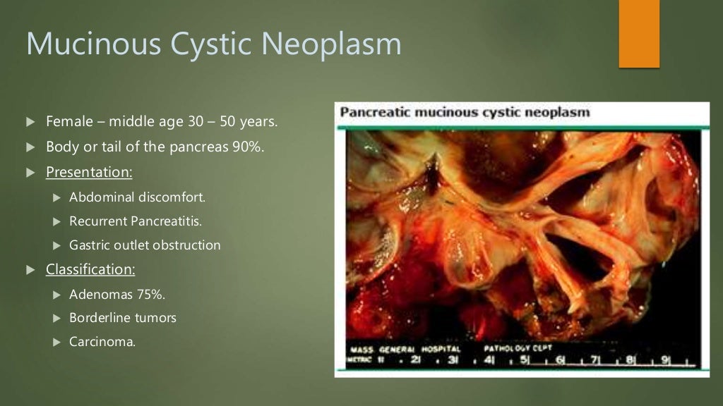 Pancreatic cystic neoplasm: Definition, Classification, Diagnosis and…
