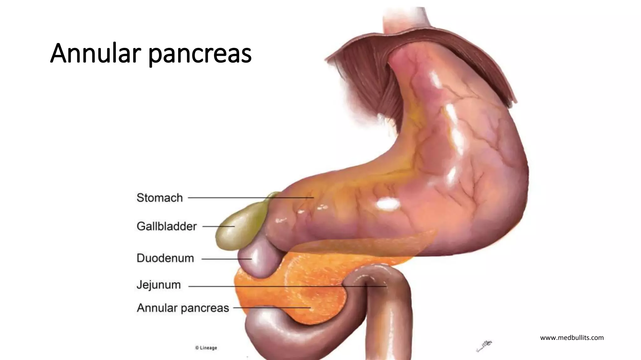 Pancreatic development and aberations - Dr M Barnard | PPTX | Endocrine and Metabolic Diseases ...