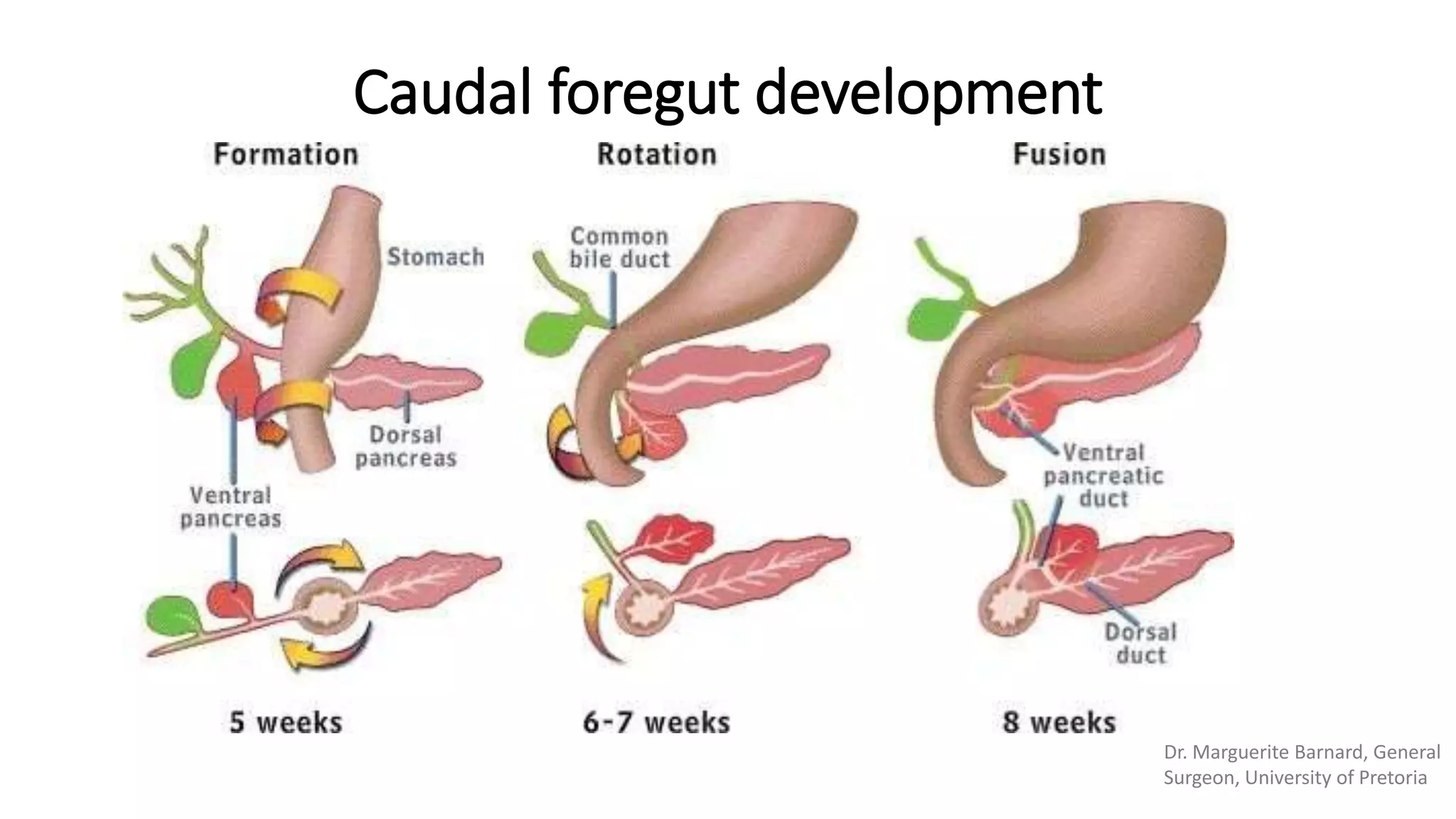Pancreatic development and aberations - Dr M Barnard | PPTX | Endocrine and Metabolic Diseases ...