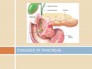 Pancreatic diseases ppt | PPT