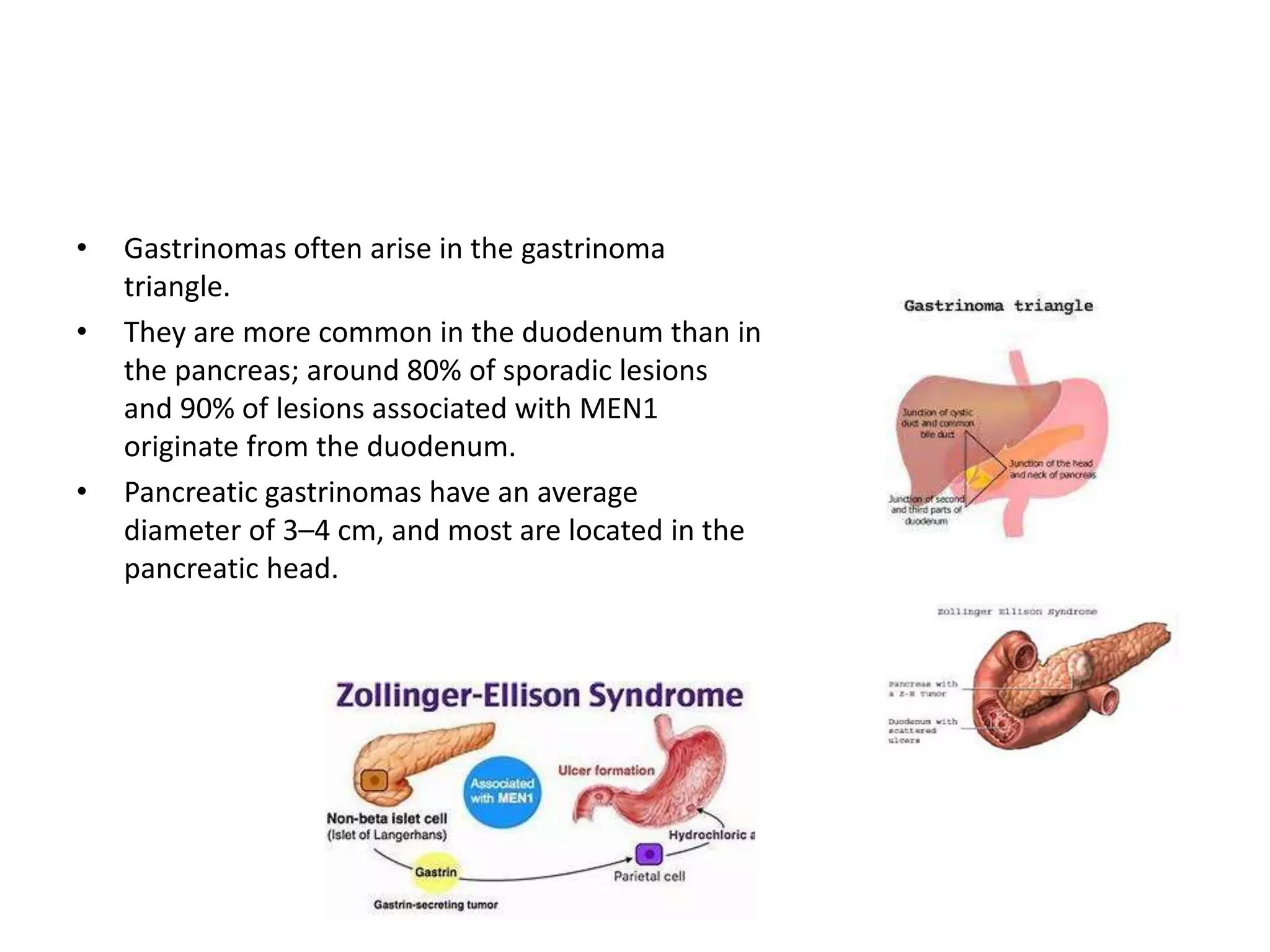 Pancreatic Endocrine Tumor imaging2.pptx
