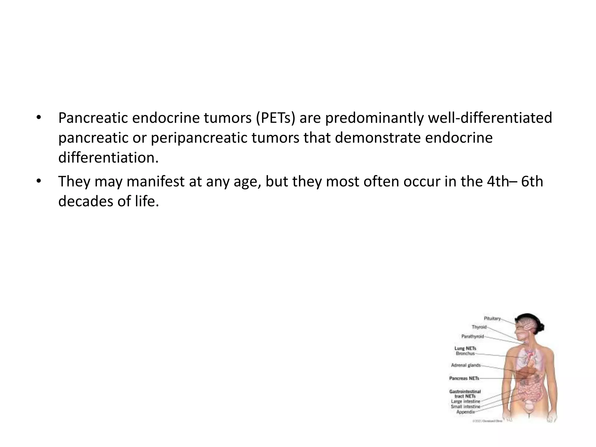 Pancreatic Endocrine Tumor imaging2.pptx