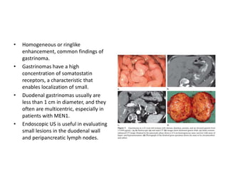 Pancreatic Endocrine Tumor imaging2.pptx