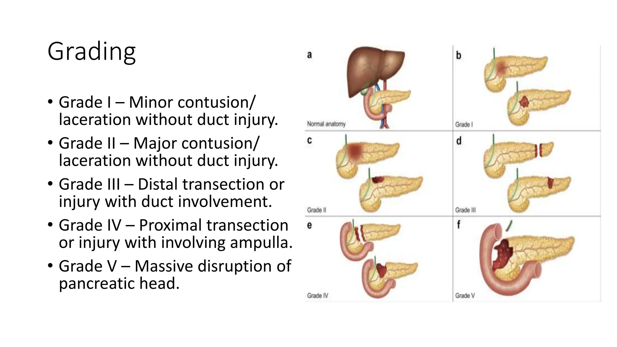 PANCREATIC INJURY.ppt.pptx