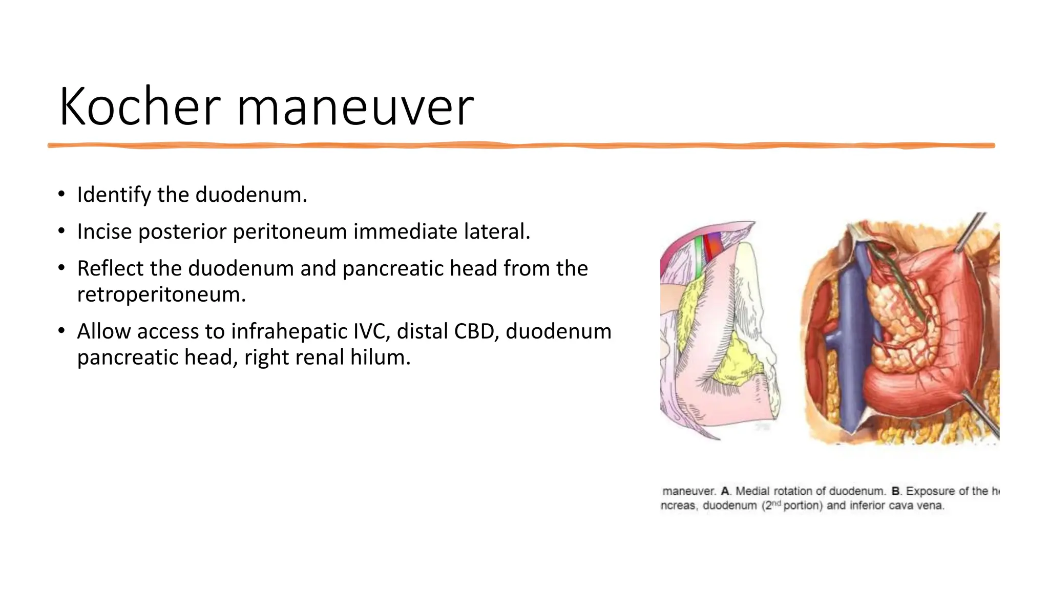 PANCREATIC INJURY.ppt.pptx