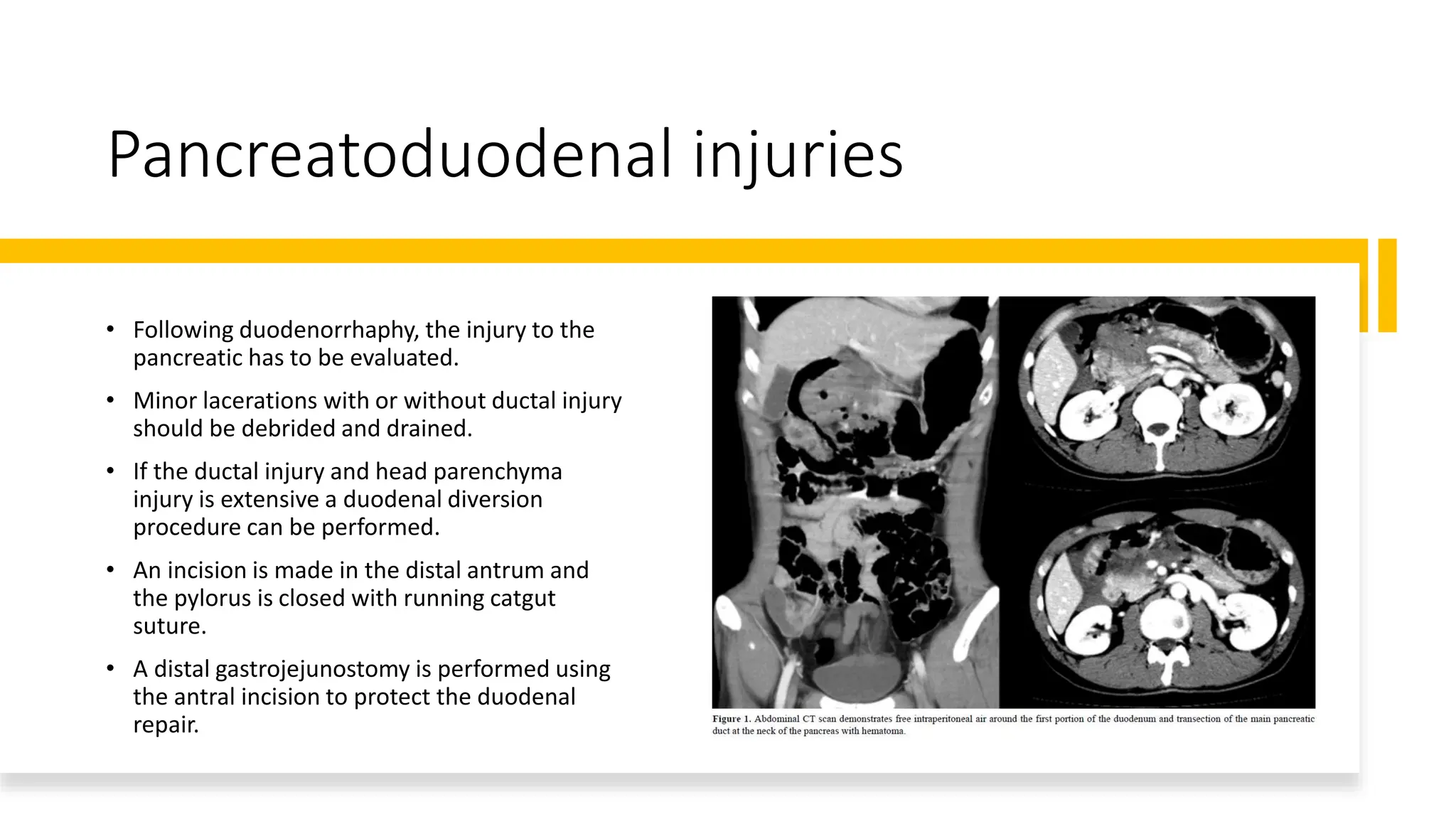 PANCREATIC INJURY.ppt.pptx