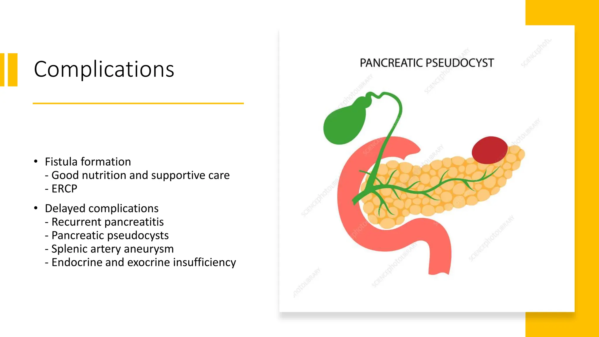 PANCREATIC INJURY.ppt.pptx