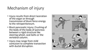 PANCREATIC INJURY.ppt.pptx