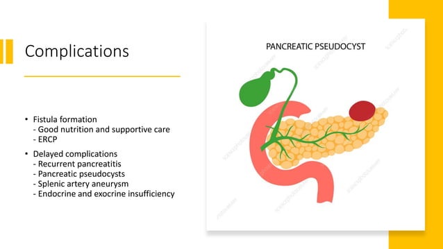 PANCREATIC INJURY.ppt.pptx