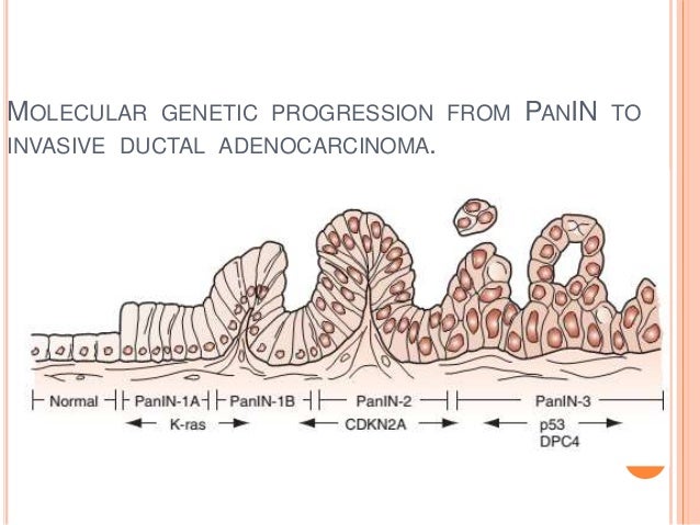 Pancreatic neoplasms