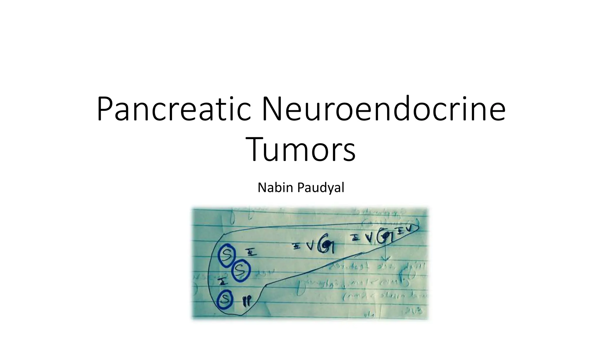 Management of Pancreatic Neuroendocrine tumors.pptx