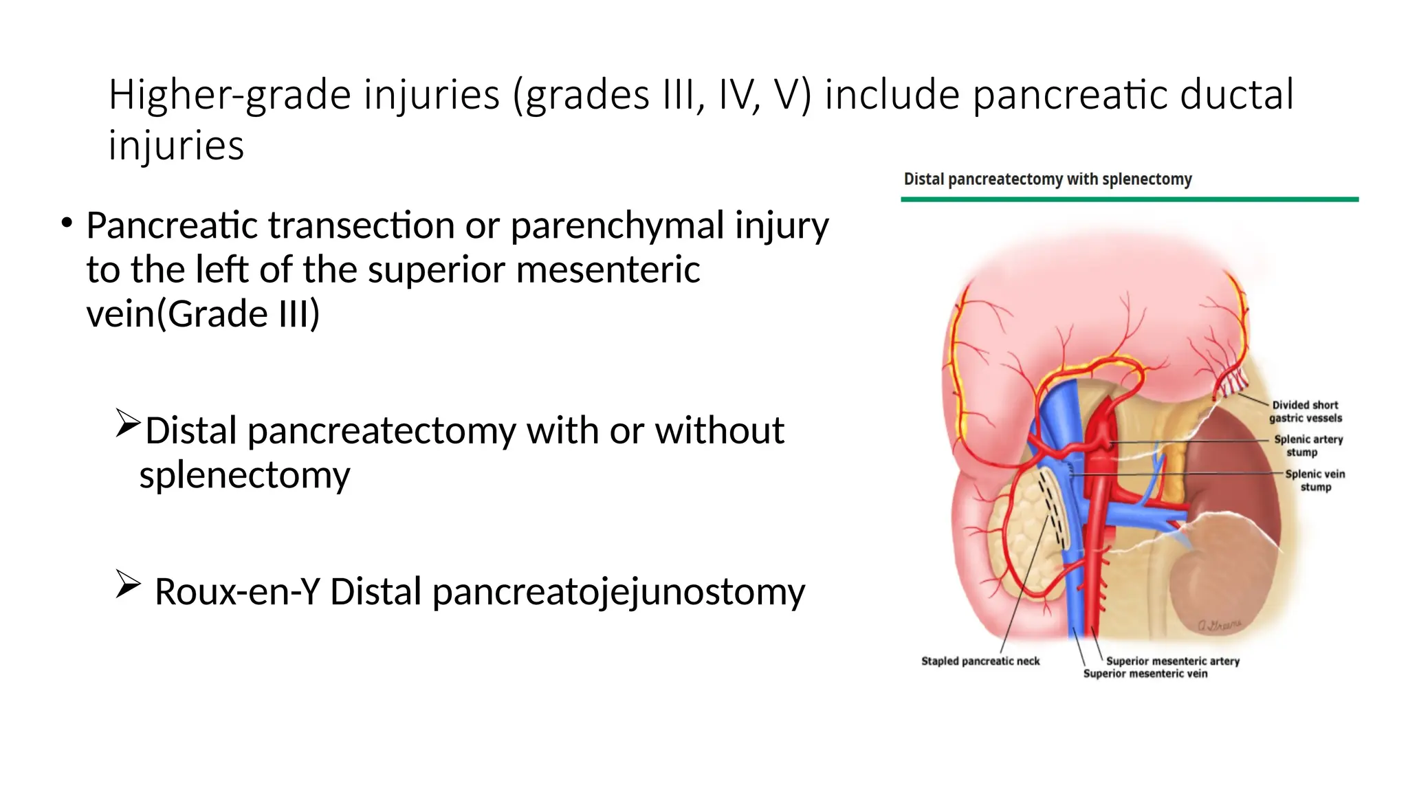 Pancreaticodudenal Complex Injury01.pptx