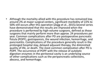 Pancreaticoduodenectomy or whipple procedure | PPTX
