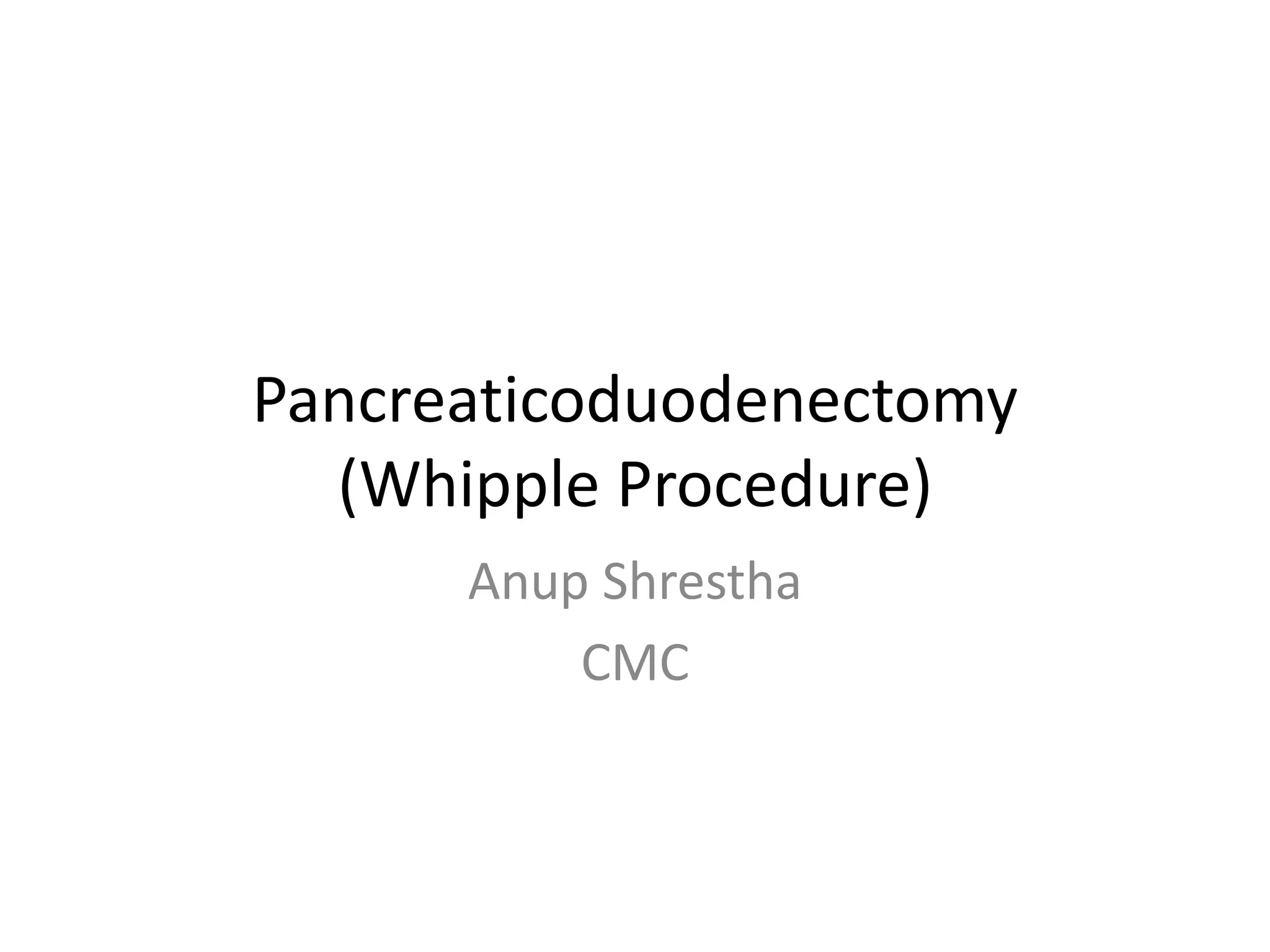 Pancreaticoduodenectomy (whipple procedure) | PPTX