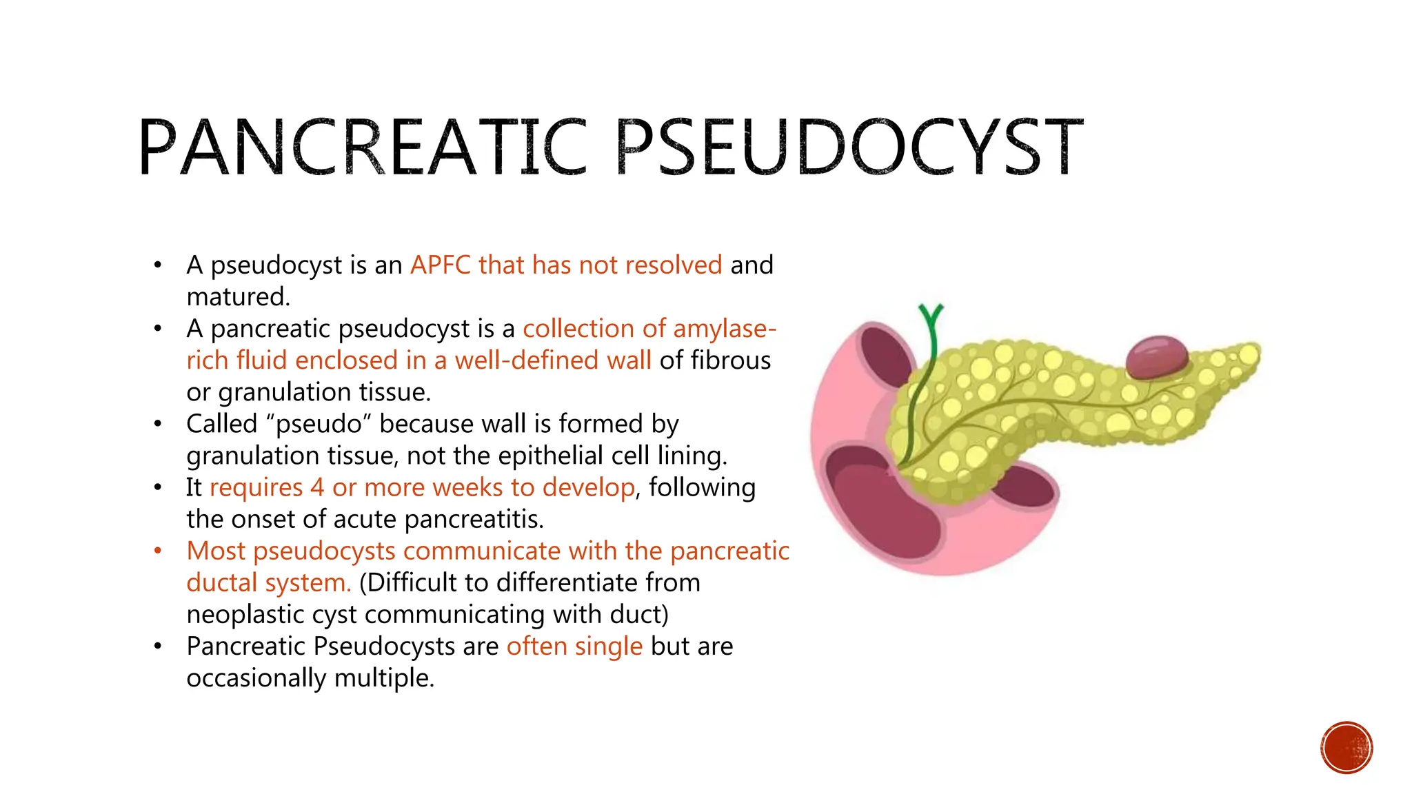 Pancreatic Pseudocyst - Dr Imran Ali Arain.pptx