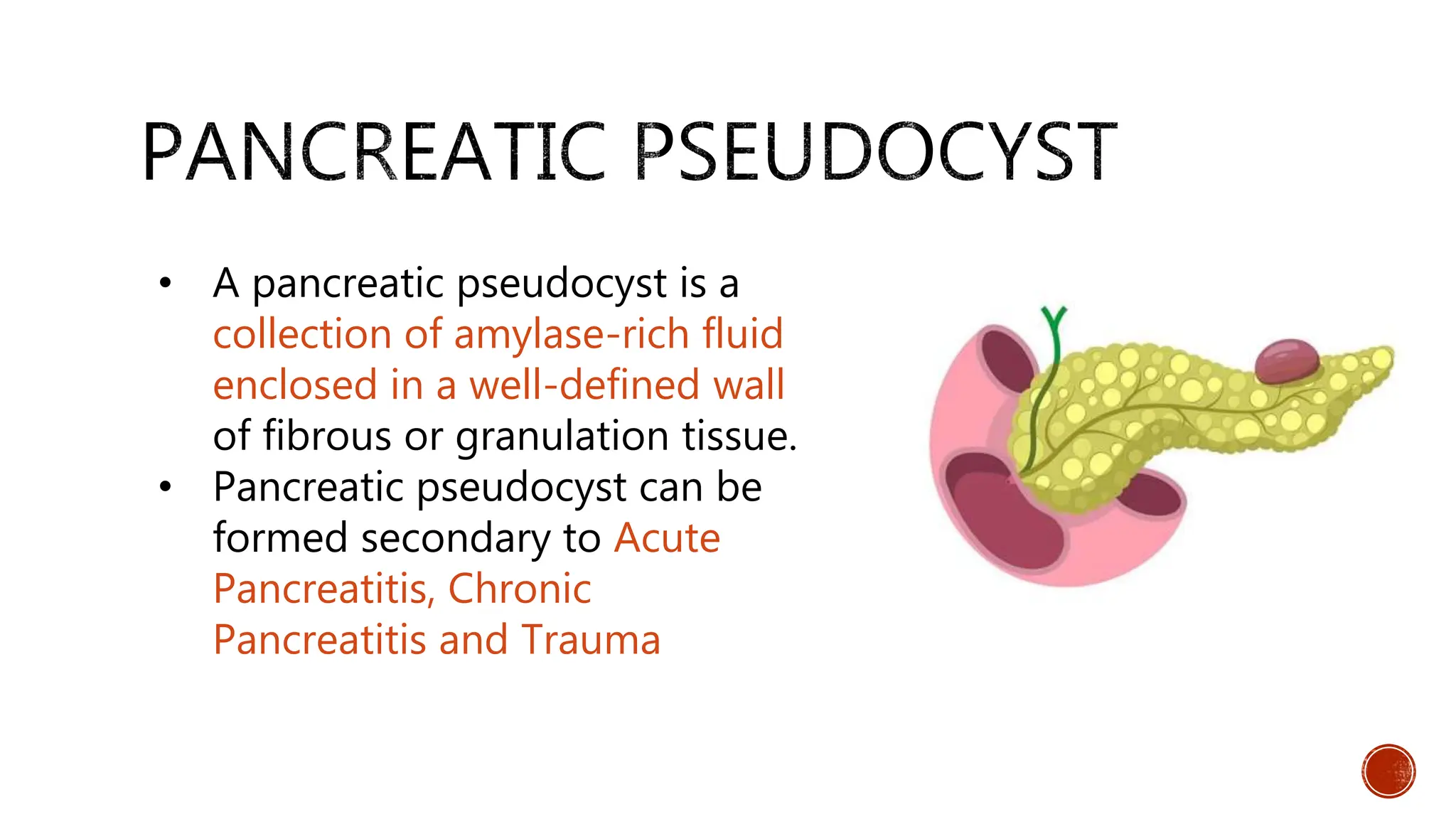 Pancreatic Pseudocyst - Dr Imran Ali Arain.pptx