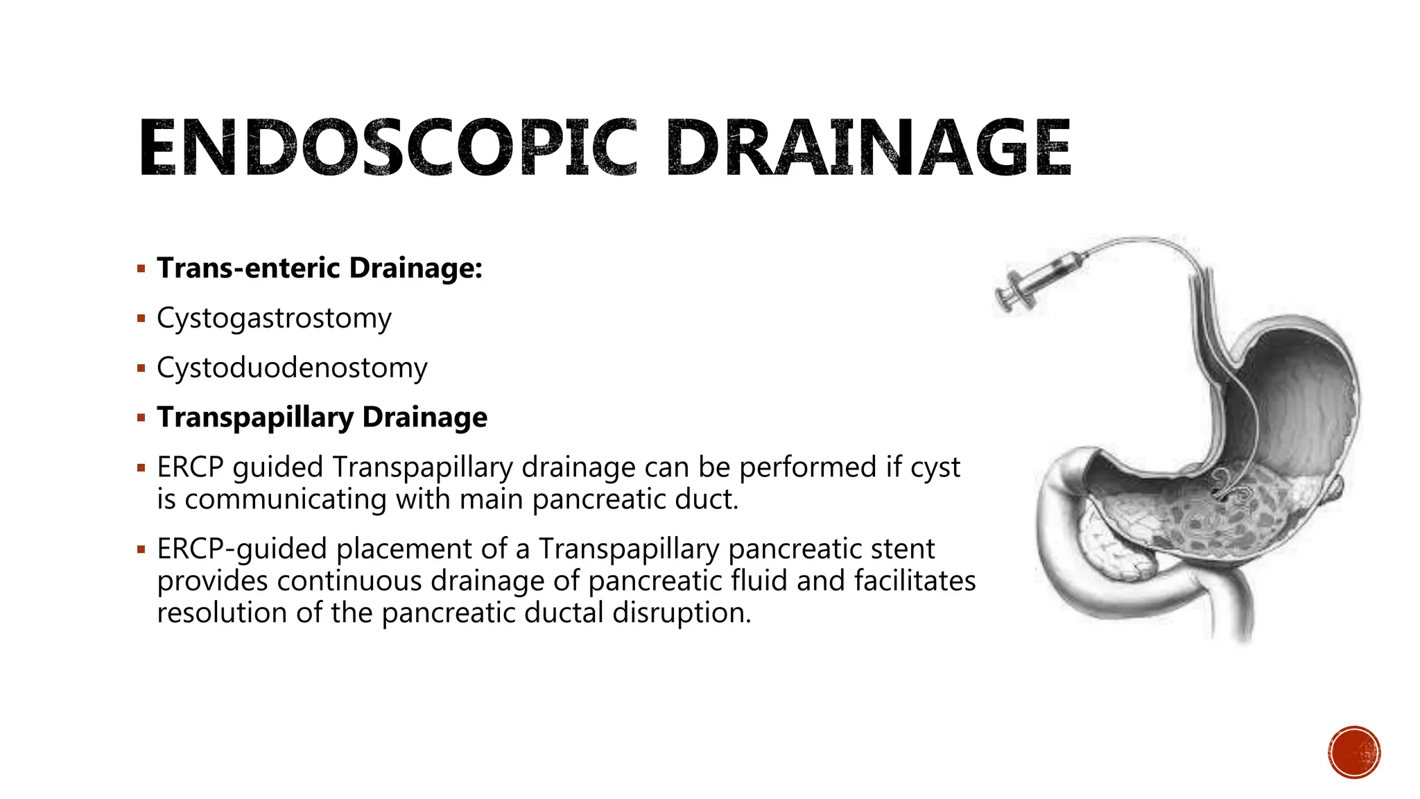 Pancreatic Pseudocyst - Dr Imran Ali Arain.pptx