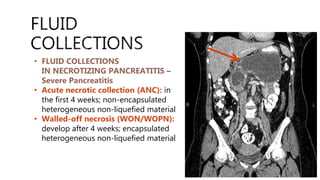 Pancreatic Pseudocyst - Dr Imran Ali Arain.pptx