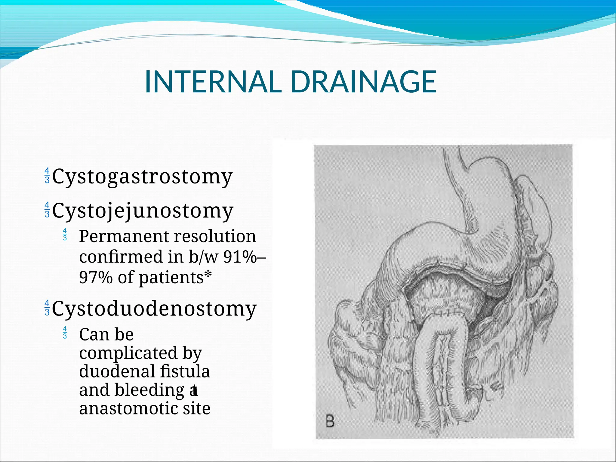 pancreatic pseudocyst presentation 1.pptx