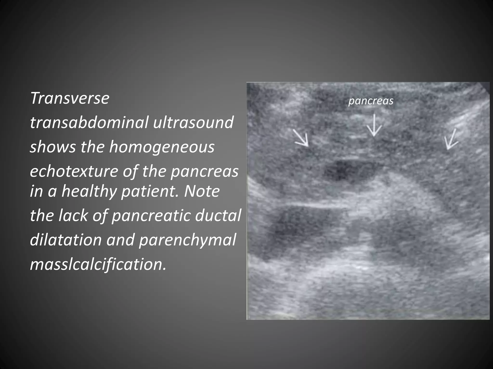 Pancreatic sonographic anatomy | PPTX