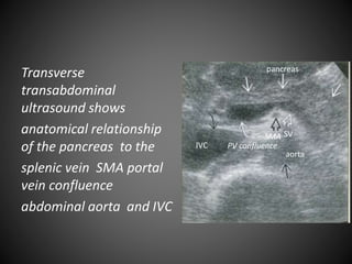 Pancreatic sonographic anatomy | PPTX