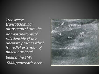Uncinate Process Ultrasound