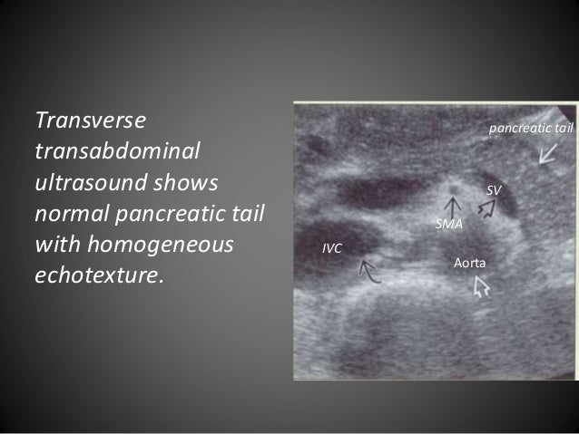 Pancreatic sonographic anatomy