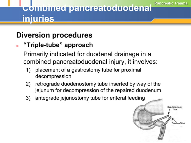 The Management of Pancreatic Trauma in the Modern Era | PPTX