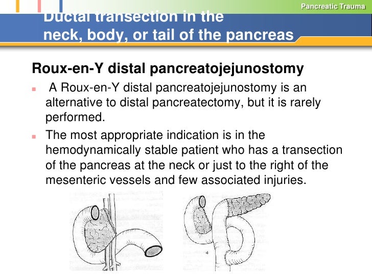 The Management of Pancreatic Trauma in the Modern Era