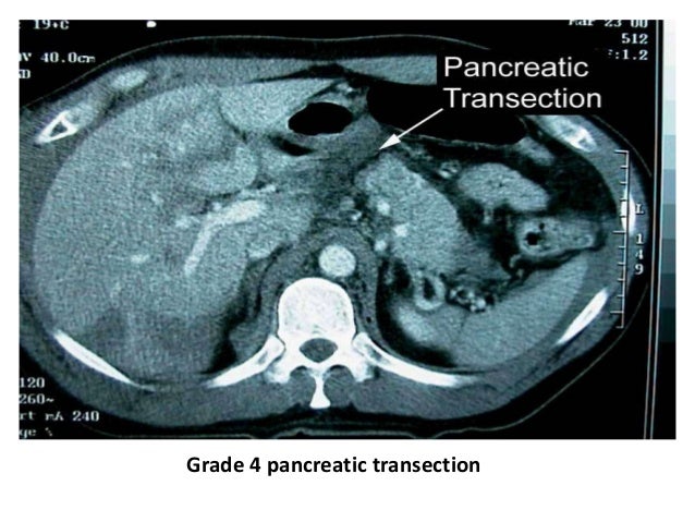 Pancreatic Trauma