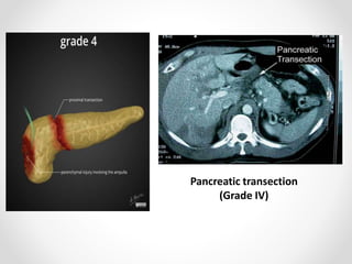 Pancreatic trauma | PPTX