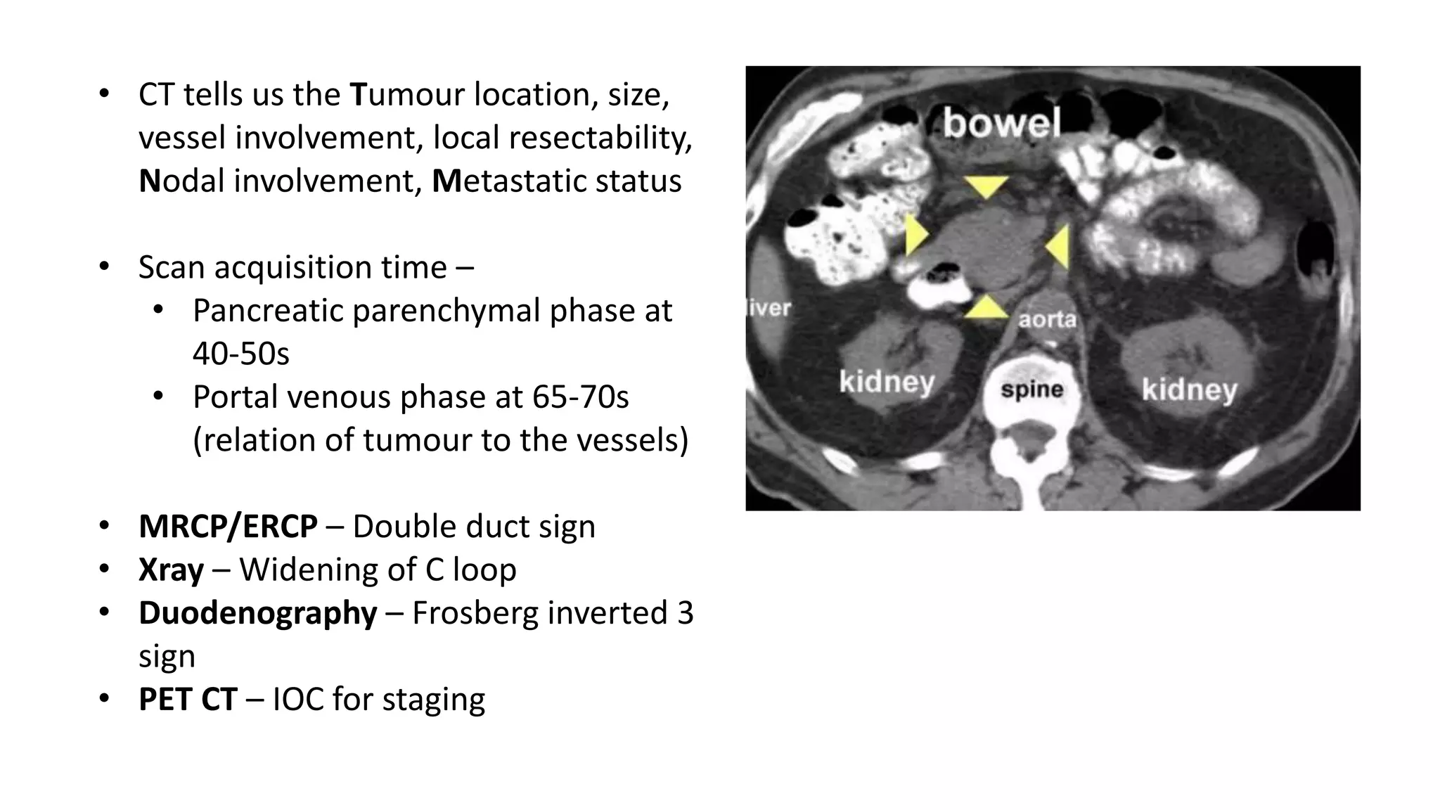 Pancreatic tumors .pptx