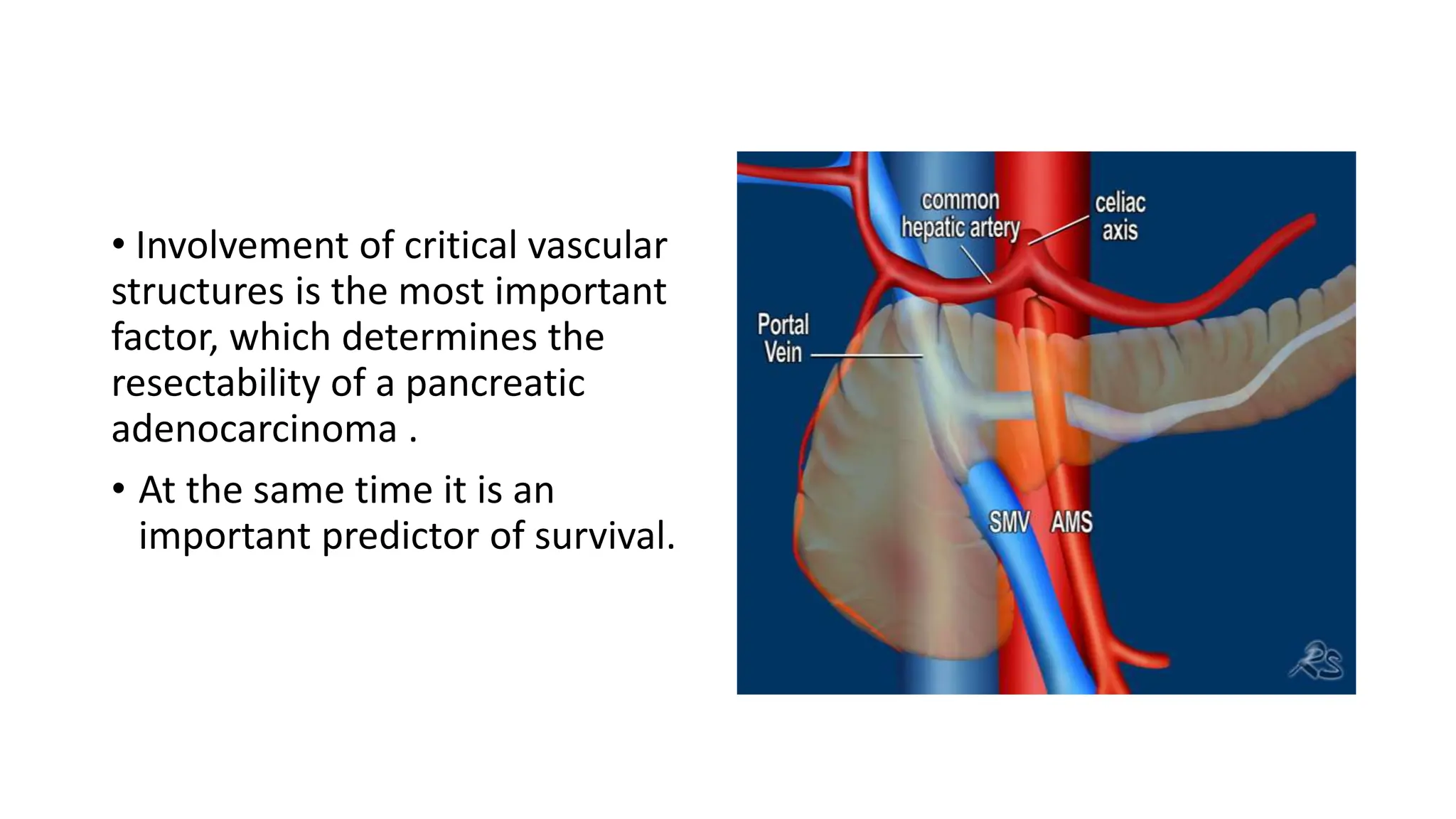 Pancreatic tumours.ppt.pptx