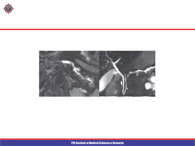 PANCREATIC TUMOURS radiology imaging.pptx