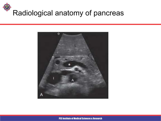 PANCREATIC TUMOURS radiology imaging.pptx