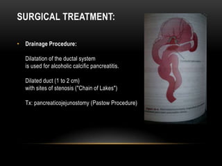 Pancreatitis | PPTX | Digestive Disorders | Diseases and Conditions