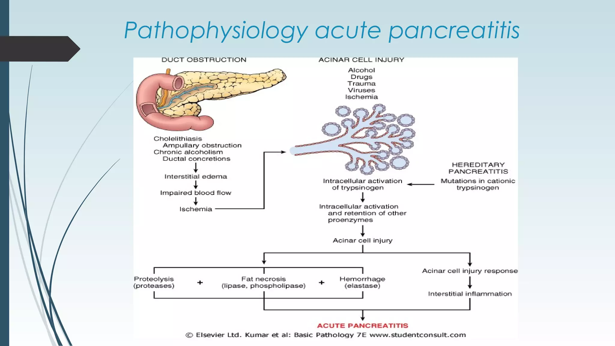 Pancreatitis | PPT